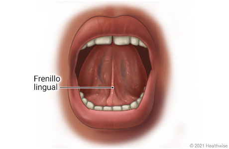 Frenillo lingual | Cigna